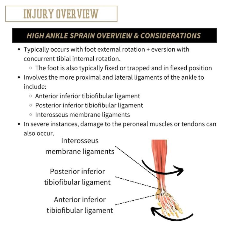 Return to Play Case Study Module 1: High Ankle Sprain for Football